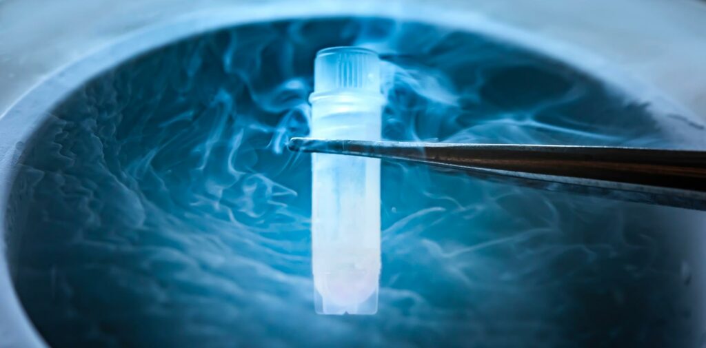 Cryopreserved PBMCs Offer Advantages Over Fresh | AllCells