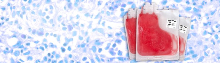 GMP Cryopreserved Leukopak | AllCells®